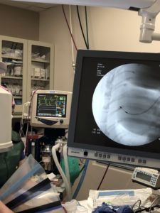 Permanent Pacemaker Placement in Dogs - Friendship Hospital for Animals